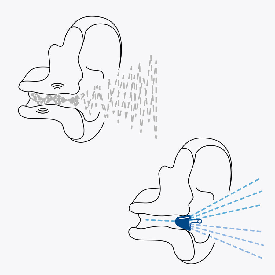 Calmer® | A Premium Alternative To Traditional Earplugs – Flare Audio Ltd